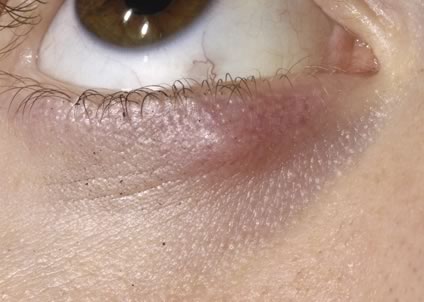 Oftan Dexa Chlora Мазь Инструкция - leadinginstrukciya